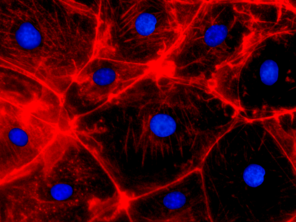 Quantitative phase microscopy – principles, instrumentation and ...
